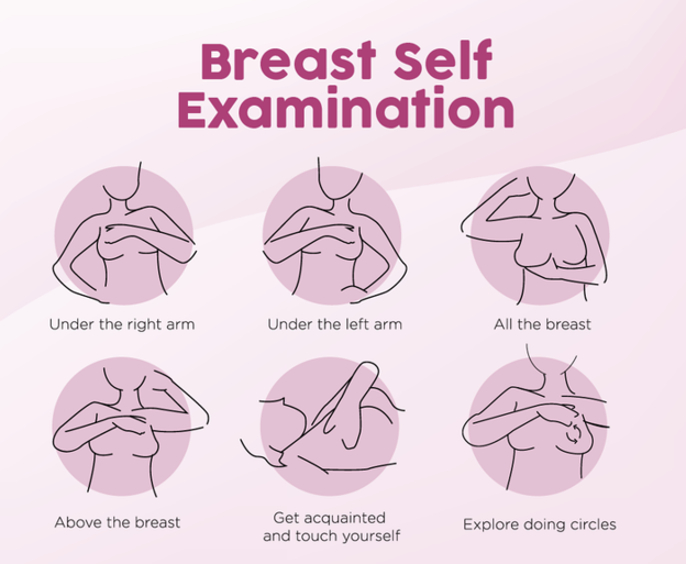 Breast Checks – Helpdesk